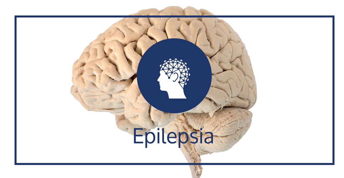 ¿Cuáles son los tratamientos para la epilepsia? - ClikiSalud.net | Fundación Carlos Slim