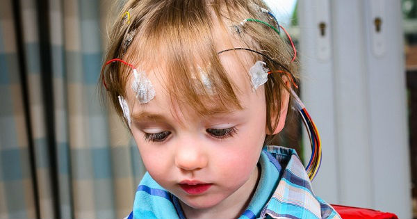 Síndromes epilépticos - ClikiSalud.net | Fundación Carlos Slim ...