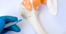 Biopsia de médula ósea, lo que debes saber