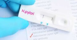 4 pruebas para detectar la bacteria Helicobacter Pylori