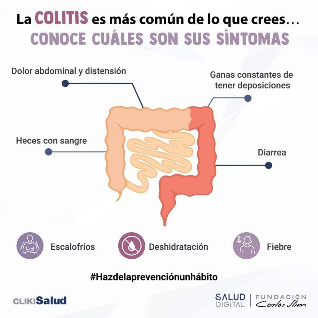 La colitis es más común de lo que crees - ClikiSalud.net | Fundación ...