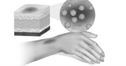 4 causas que ocasionan una infección en la piel