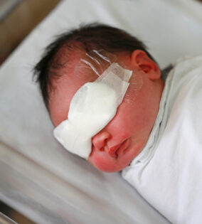 Anormalidades congénitas del párpado - ClikiSalud.net | Fundación ...