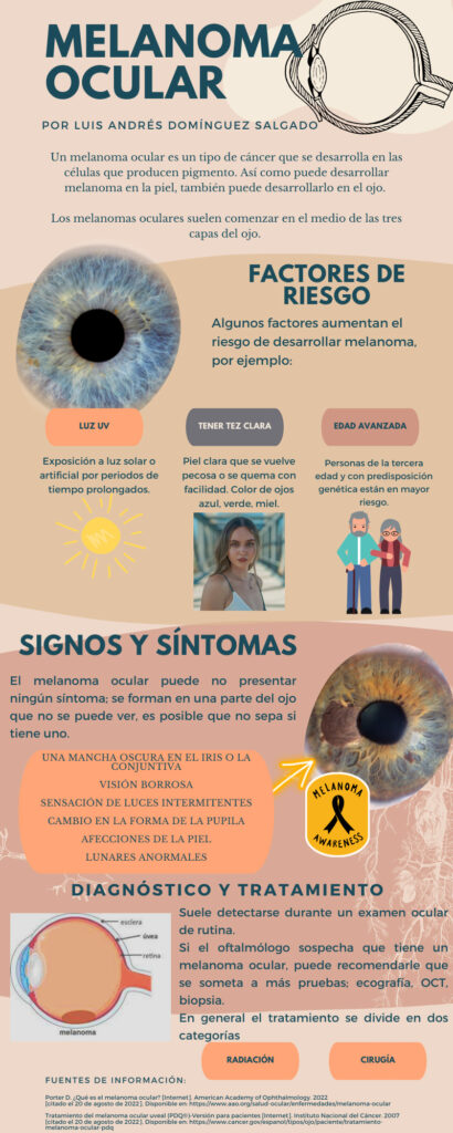 Melanoma ocular - ClikiSalud.net | Fundación Carlos Slim