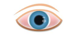 Úlceras corneales, ¿qué son y cuáles son sus síntomas?