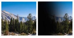 Pérdida de la mitad de la visión periférica e infarto cerebral, lo que ...