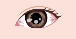 Queratitis, ¿qué es y cuáles son sus tipos y síntomas?