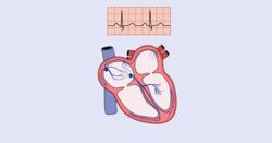 Impulsos eléctricos en el corazón, ¿cuál es su función?