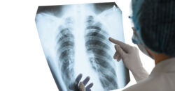 Tipos y causas de un pulmón perforado