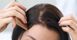 8 causas que dan lugar a comezón en el cuero cabelludo