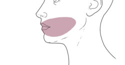 Síndrome de boca ardiente, lo que debes saber - ClikiSalud.net ...